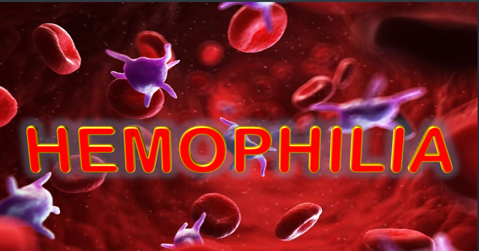 Net4Hemo: Understanding the Basics : Hemophilia