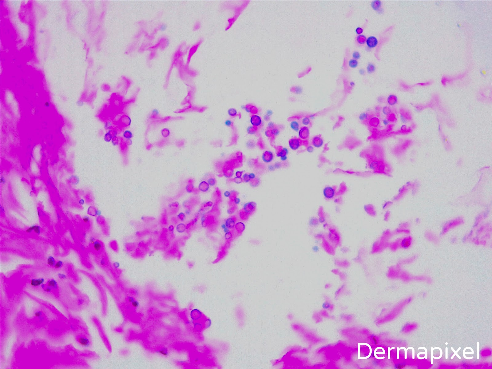 Dermapixel: julio 2017