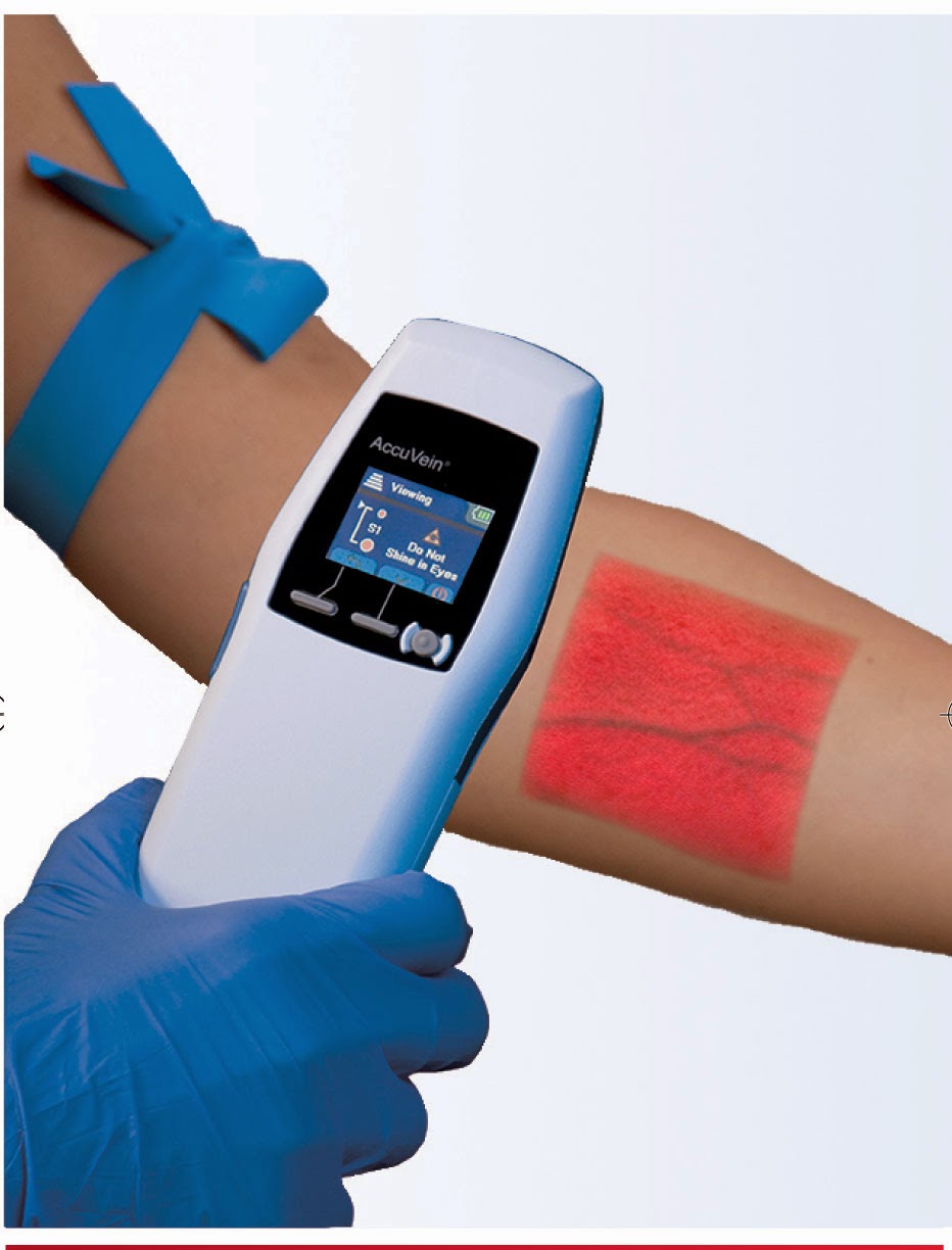 Tecnologia da Informação e a Medicina: AccuVein AV300: aguarda ...