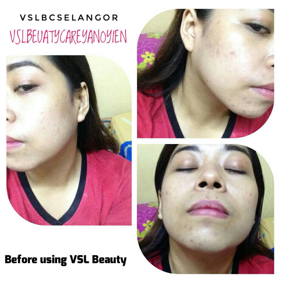 PRODUK PEMUTIH DAN PENGELUPASAN VSL BEAUTY CARE: July 2018