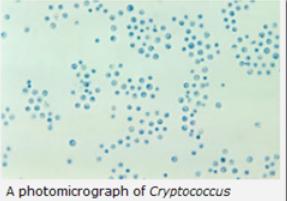 Avian Flu Diary: EID Journal: Whole-Genome Analysis of Cryptococcus ...