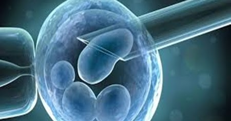 Pemeriksaan Kondisi Dalam Rahim Dan Saluran Telur dengan HSG