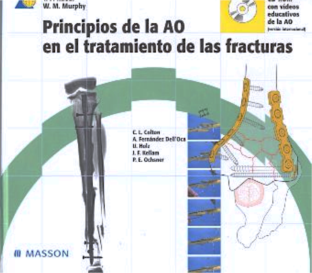 Tutomedic: Principios de la AO en el tratamiento de las fracturas