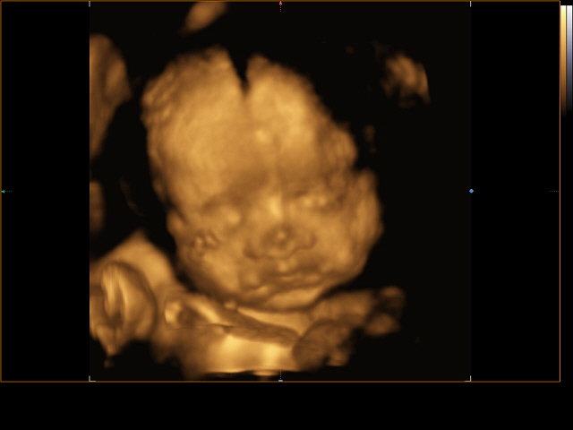My Simple but Nice Life: 3D/ 4D Scan Baby Scan - 26 Weeks Di Vision College