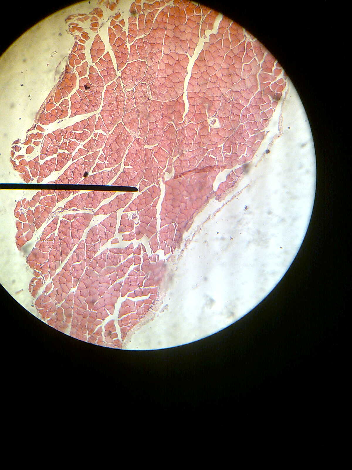 Skeletal Muscle Cells Under Microscope