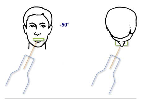 Dentistry and Medicine: Intraoral Radiographic Techniques (Intraoral ...