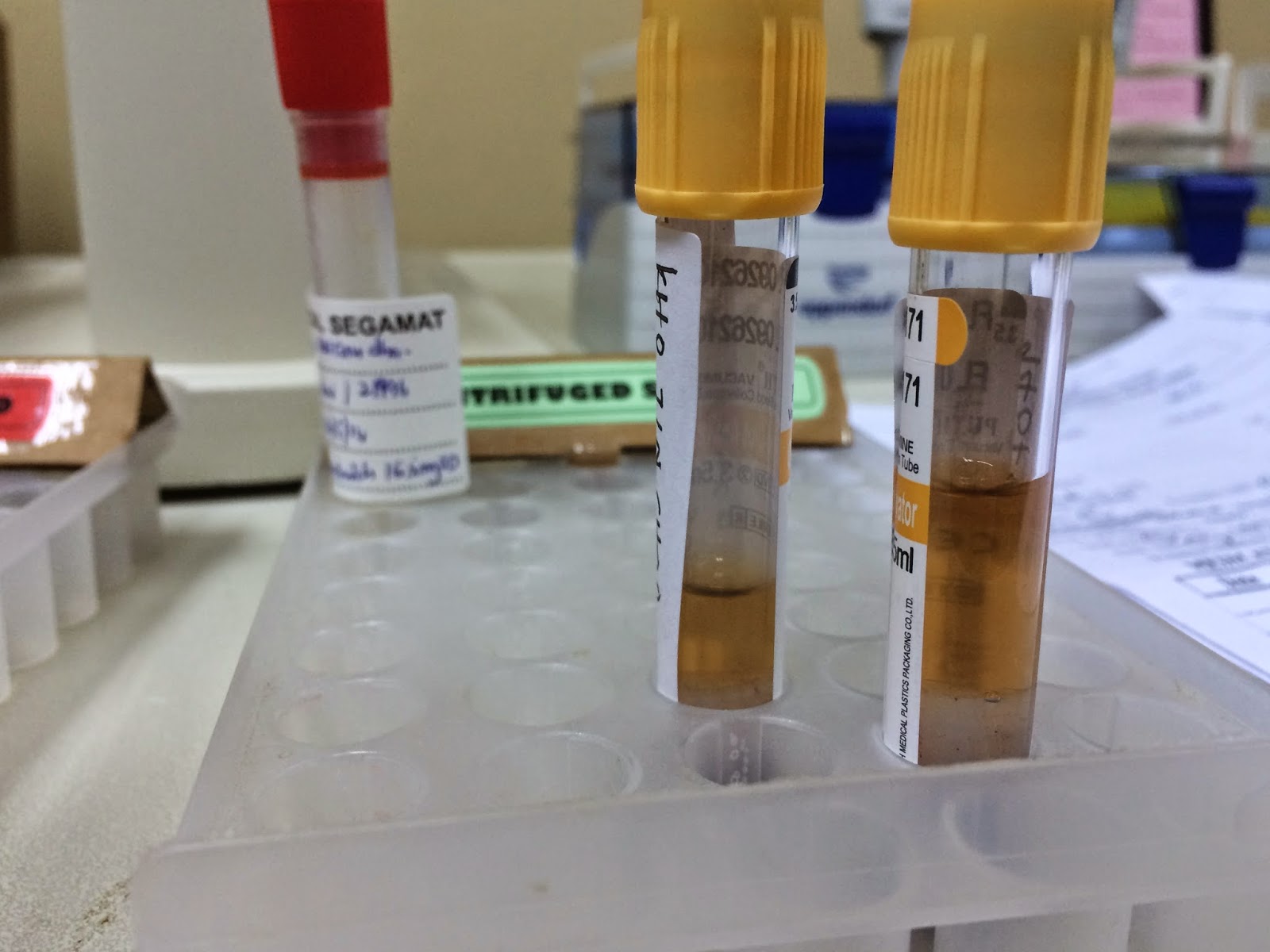 ini blog farmasi: Therapeutic Drug Monitoring (TDM) 101