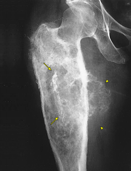 EL RINCÓN DE LA MEDICINA INTERNA. juanpedromacaluso@yahoo.com.ar ...