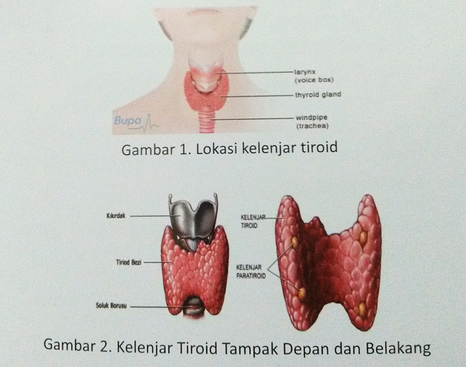 Kenali Gejala Gangguan Tiroid Sejak Dini, Jangan Sepelekan! ~ Catatan ...