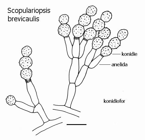 Microbiología y Epidemiología: Trichophyton rubrum. Trichophyton ...