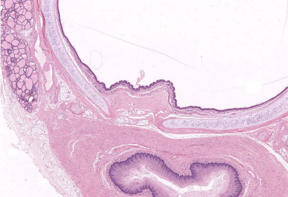 μicroscopia: TRACHEA, ESOFAGO E TIROIDE