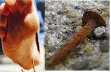 Penyakit tetanus, tanda gejala dan pengobatan tetanus - askepdb ...