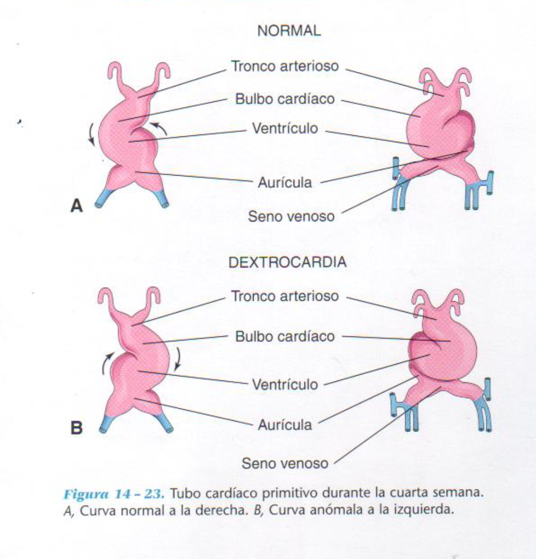 ESBOZOS MÉDICOS: ANOMALÍAS EMBRIOLÓGICAS APARATO CARDIOVASCULAR