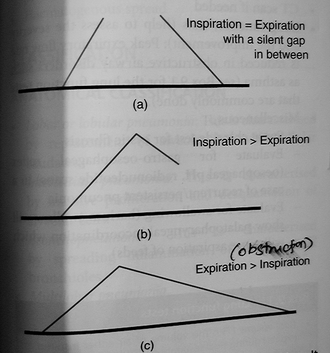 Acute Respiratory Infection (ARI) and WALRI
