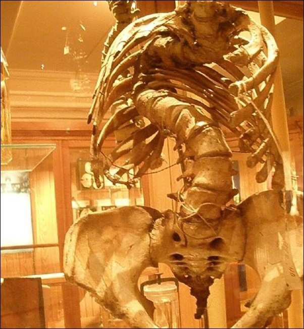 Mentes Imundas e Belas: Mutter Museum, o Museu do Terror