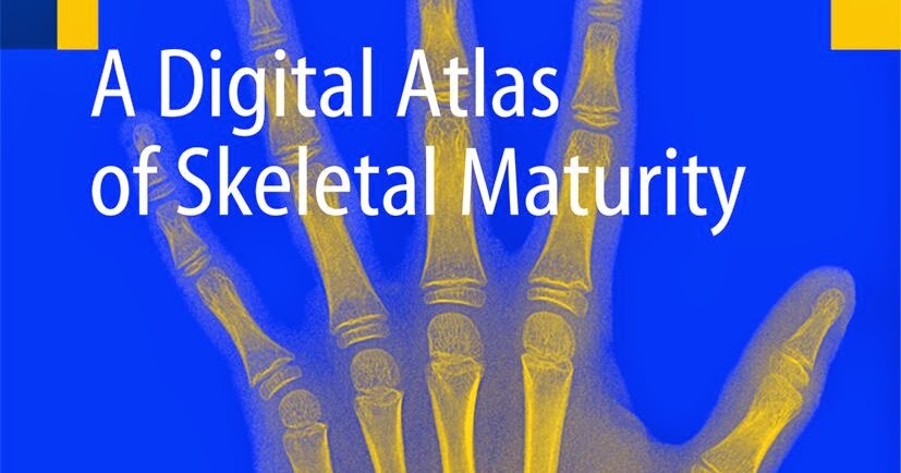 Hand Bone Age - A Digital Atlas of Skeletal Maturity - Ebooks Medical
