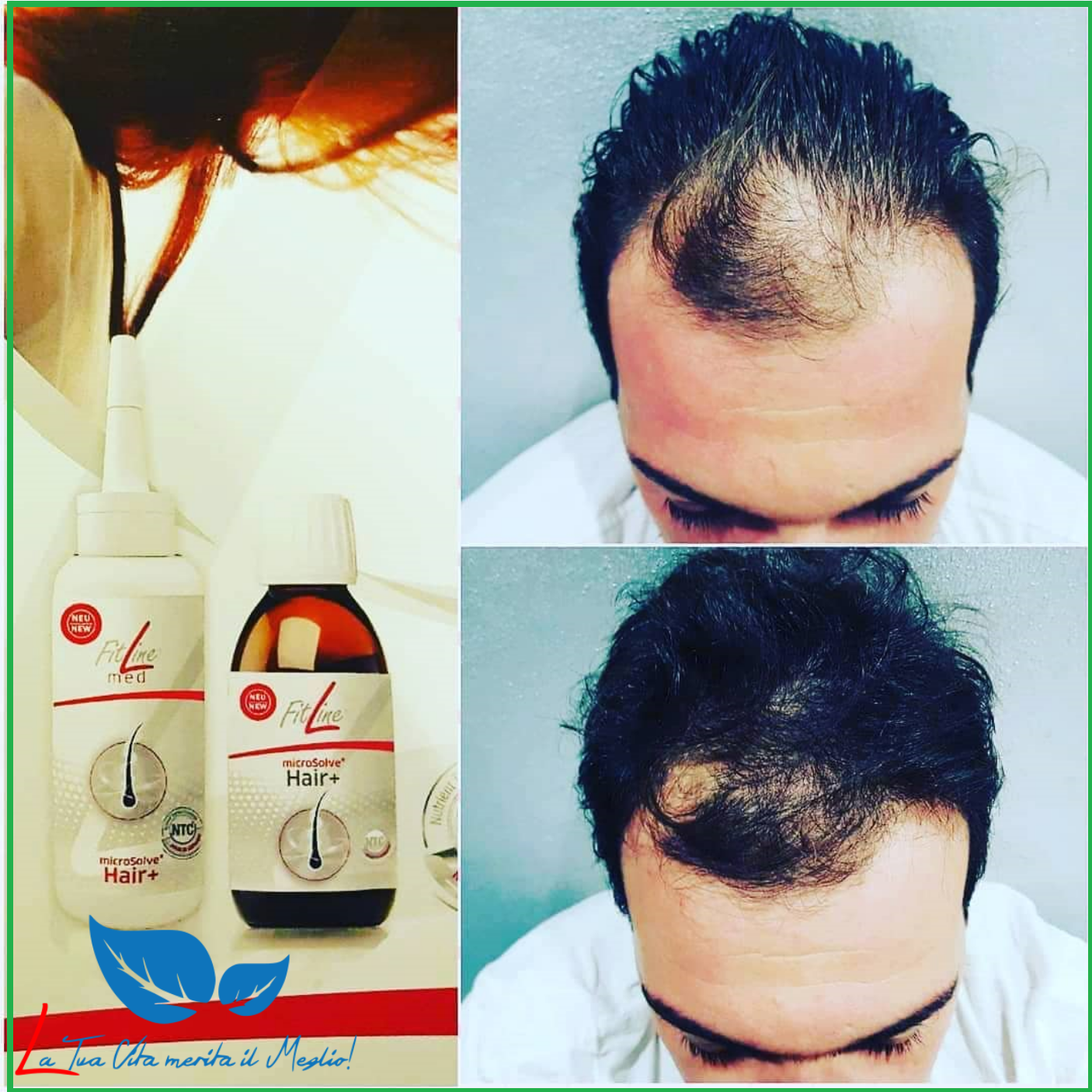 risultati-fitline-hair-prima-e-dopo