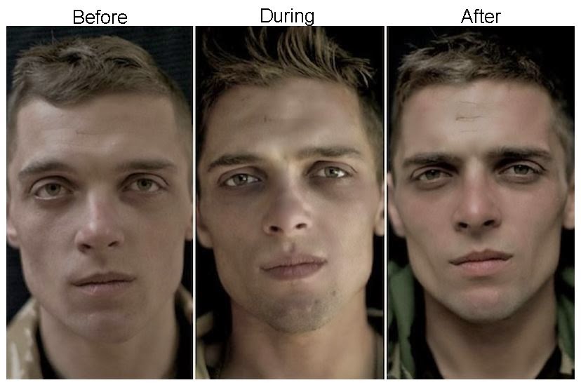 Wounded Times: PTSD is change, change again