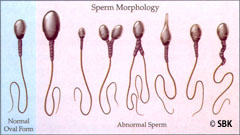 O Diário da Minha Gravidez: Valores normais do espermograma