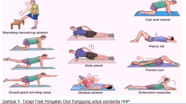 KLINIK ONLINE BEDAH ORTHOPAEDI: Herniasi Nukleus Pulposus part.2 ...