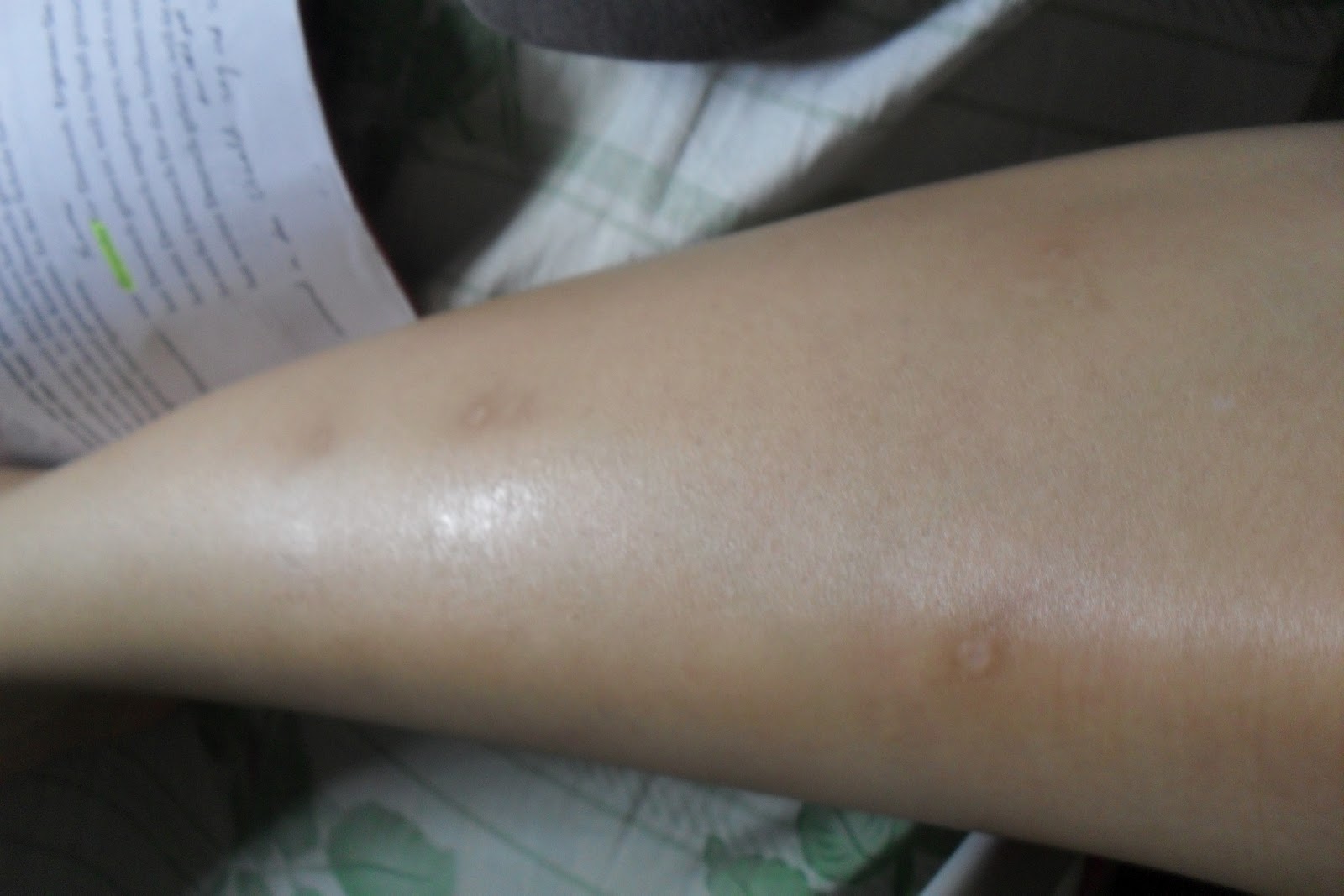 Lava Bean: Help! Scars and Boils and Rosehip oil.