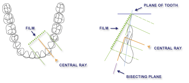 Dentistry and Medicine: Intraoral Radiographic Techniques (The ...