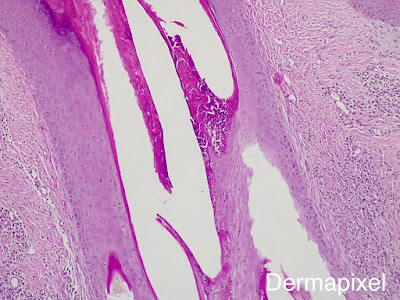 Dermapixel: abril 2018