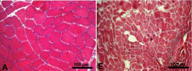 Functional Electrical Stimulation for Denervated Muscle ...