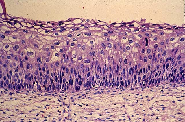 Cáncer cervicouterino : ANATOMÍA DEL APARATO REPRODUCTOR FEMENINO