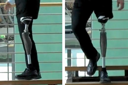 "Prótesis Biónicas: EL FUTURO HOY": "Prótesis Biónicas"