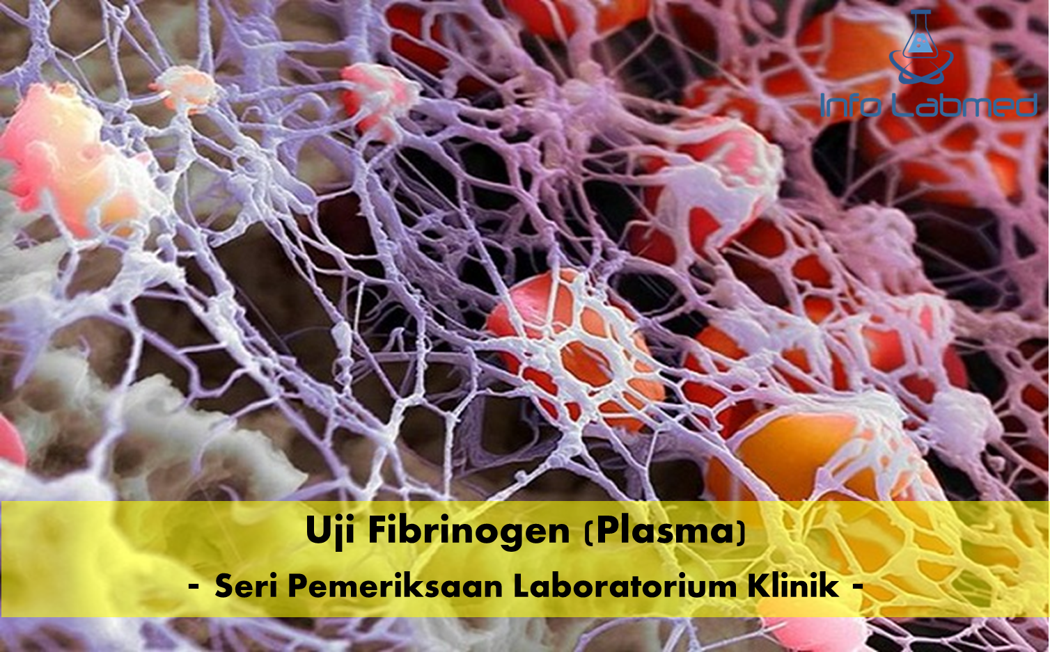 Uji Fibrinogen (Plasma) - Seri Pemeriksaan Laboratorium Klinik