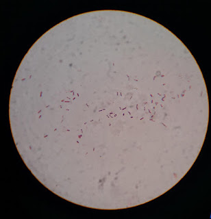 Bacillus cereus endospore stain - menuisse