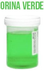 El Parte de Confirmación: Orinas?: sí que hay color!