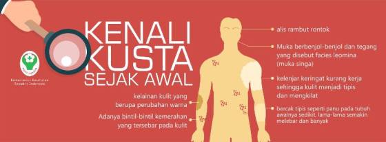 Beberapa Jenis Penyakit Pada Kulit dan Cara Pengobatannya (Kusta ...