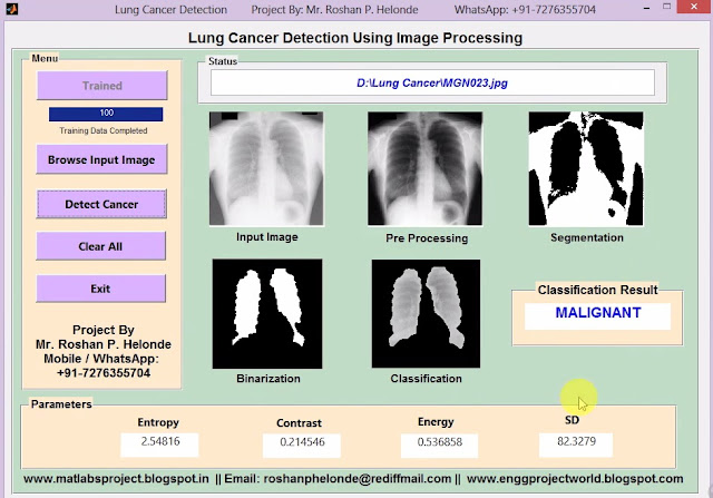 Lung Cancer Detection Using Image Processing Full Matlab Project Code ...