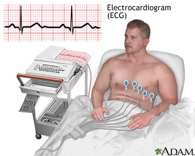 Bagaimanakah Cara Memasang 12 Lead EKG (ELEKTROKARDIOGRAFI) dengan ...