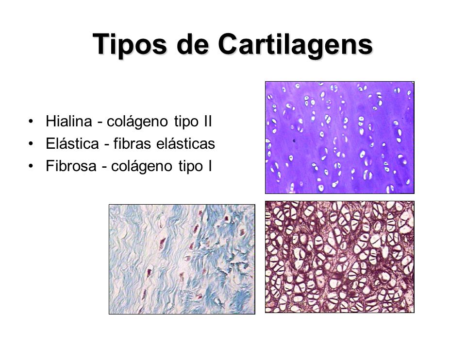 Enzima Que Come Cartilagem - RETOEDU