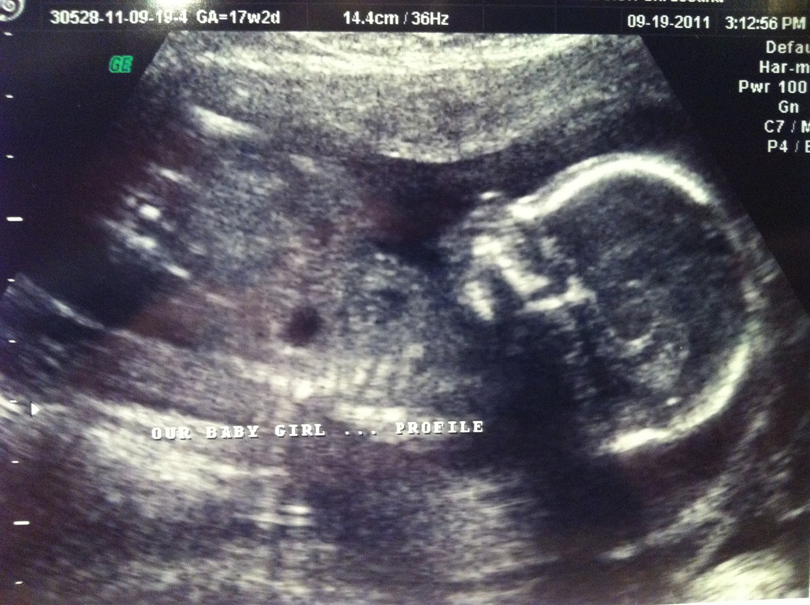 17 Week Pregnancy Update and Baby Girl Pictures - Modernly Morgan