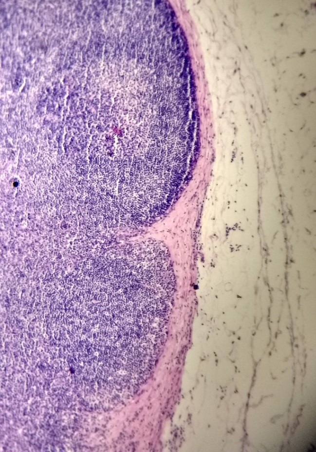 Manual interactivo de tejido conectivo: Tejido conectivo colágeno ...