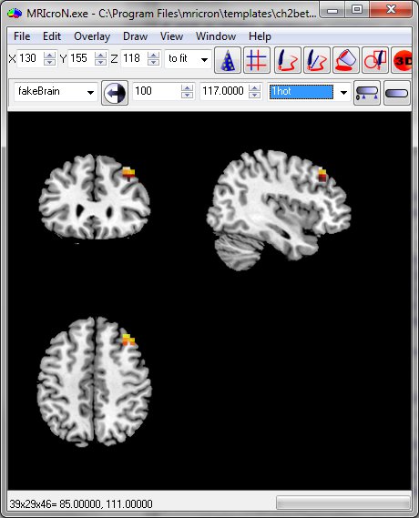 Mvpa Meanderings Working With Nifti Files In R Oronifti Code