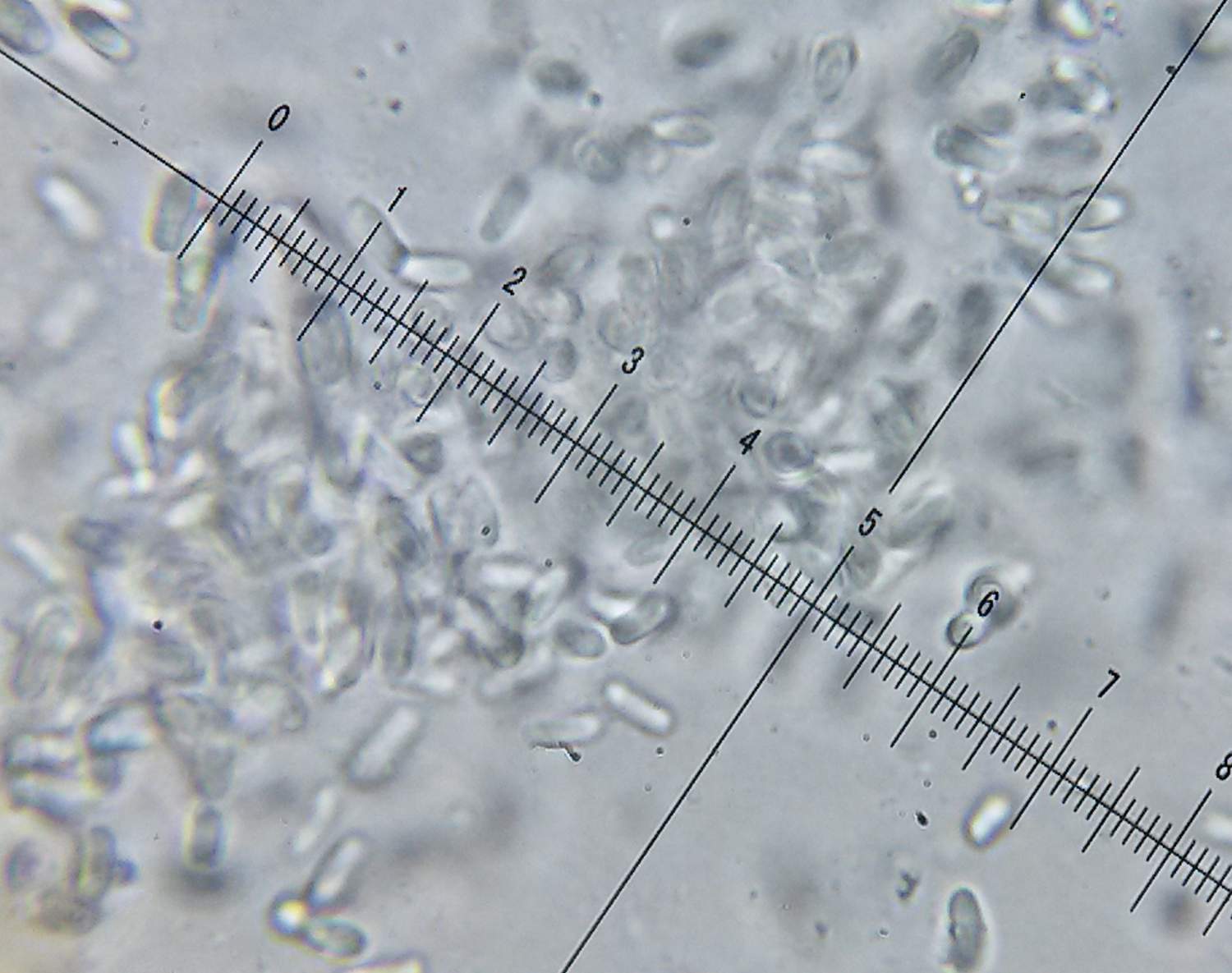 Myco Magic: Microfungi on land plants - Metasphaeria complanata at ...