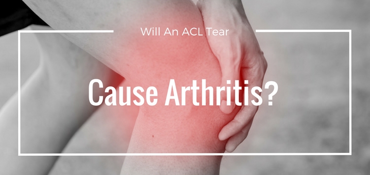 Sports and ACL Injuries: Does An ACL Tear Result In Arthritis