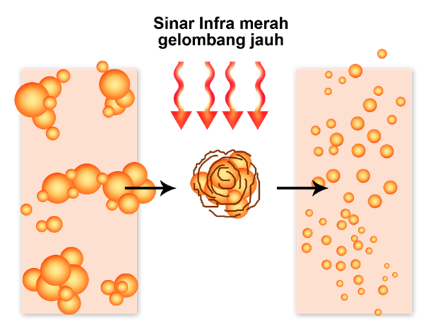 Terapi Potensial Listrik: Apa Itu Sinar Infra Merah Gelombang Jauh (Far ...