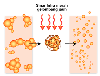 Terapi Potensial Listrik: Apa Itu Sinar Infra Merah Gelombang Jauh (Far ...