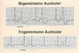 Dr. Rafael Soto - Electrocardiografía - Cardiología clínica: ¿Qué es el ...