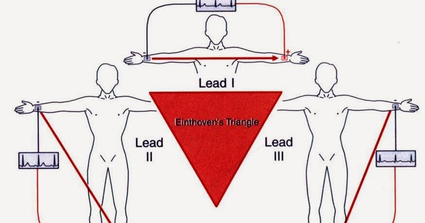 Elektrokardiografi (EKG) - dokter-medis