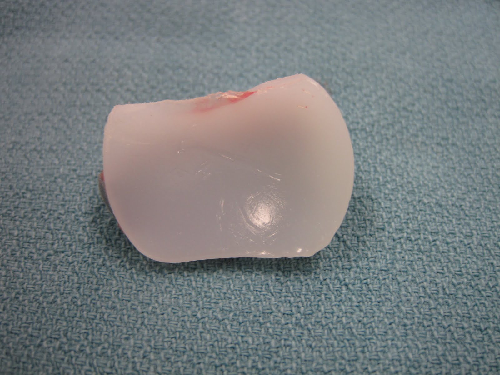 Shoulder Arthritis / Rotator Cuff Tears: causes of shoulder pain: Total ...