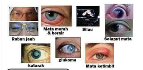 Zialisha Beauty House: AINUN BEAUTY : PENAWAR RABUN MATA