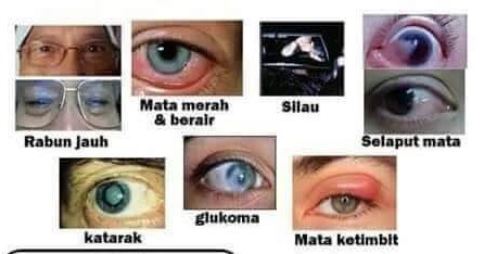 Zialisha Beauty House: AINUN BEAUTY : PENAWAR RABUN MATA