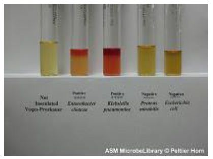 CHICAS SUPER PODEROSAS: LIQUIDO CEFALORRAQUIDEO